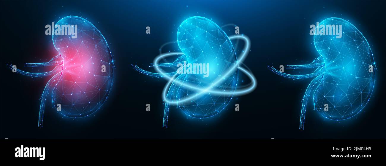 Polygonal vector illustration of inflamed diseased kidney, healthy ...