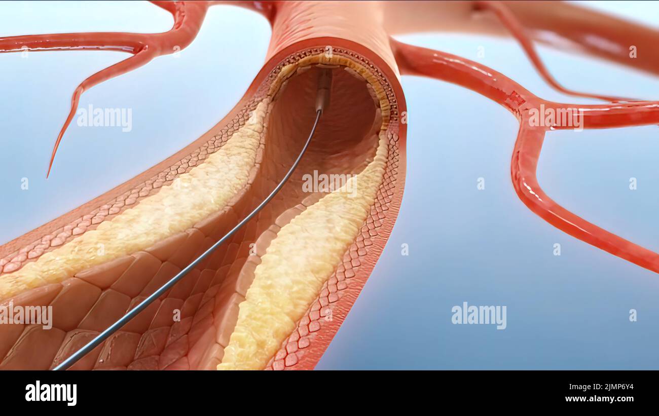 Blood flow simulation hi-res stock photography and images - Alamy