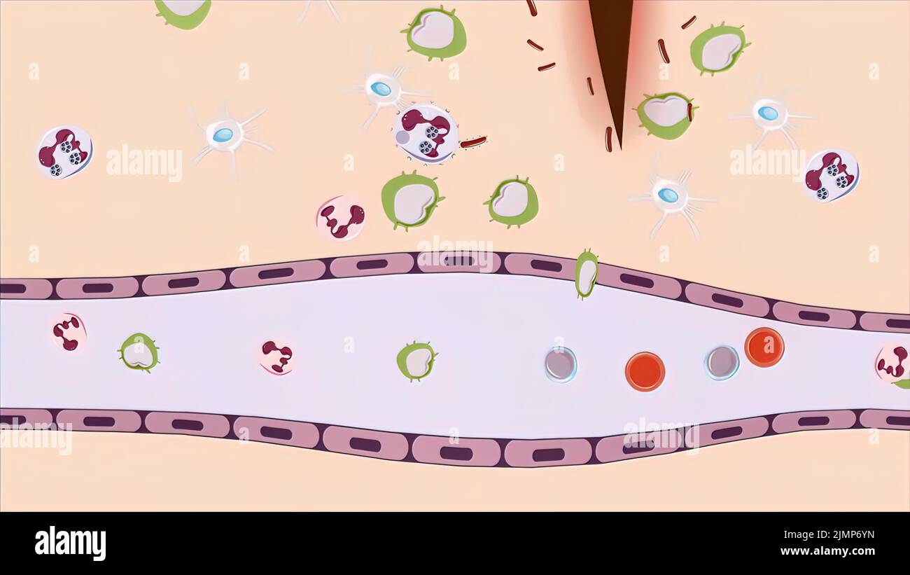 Mast cell histamine hi-res stock photography and images - Alamy