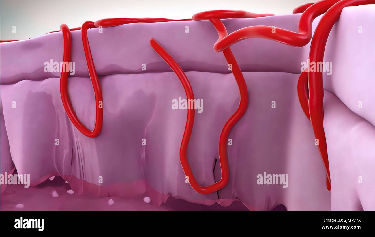 Tmj dislocation hi-res stock photography and images - Alamy