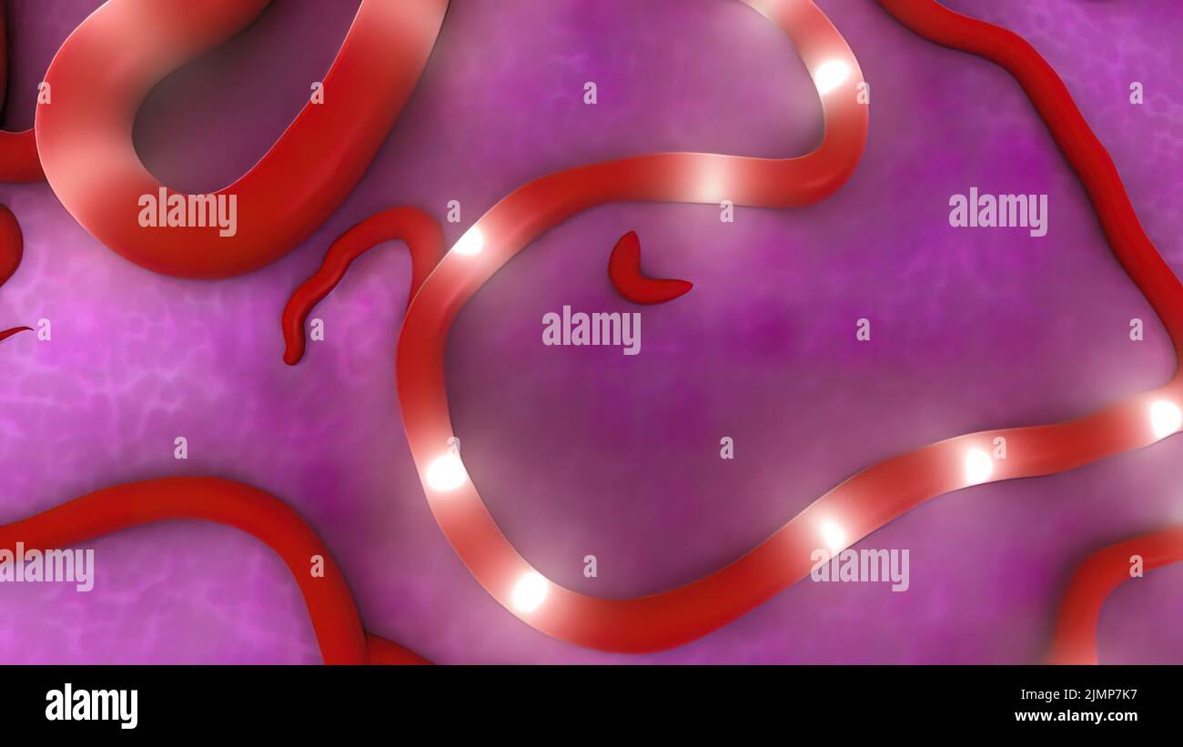 Tmj dislocation hi-res stock photography and images - Alamy