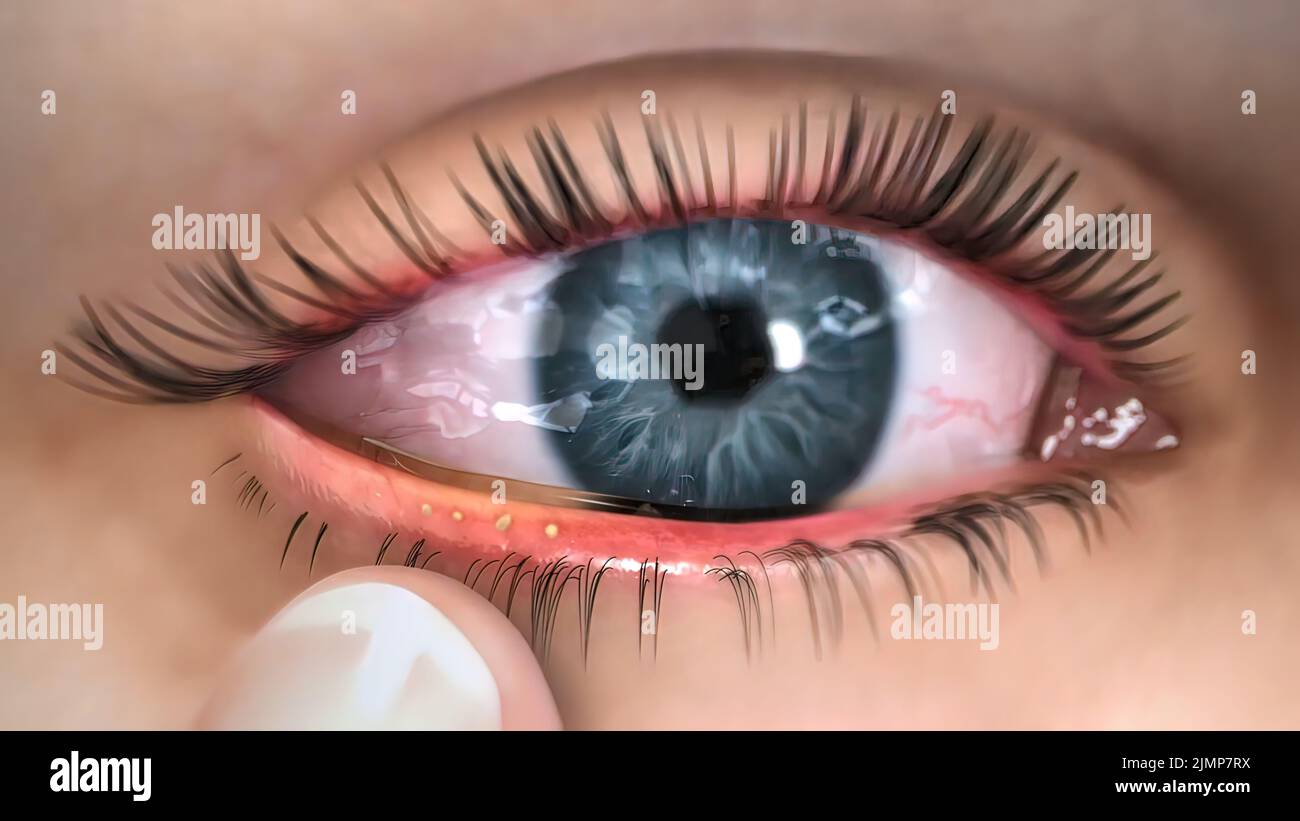 Muscle anatomy chart hi-res stock photography and images - Alamy