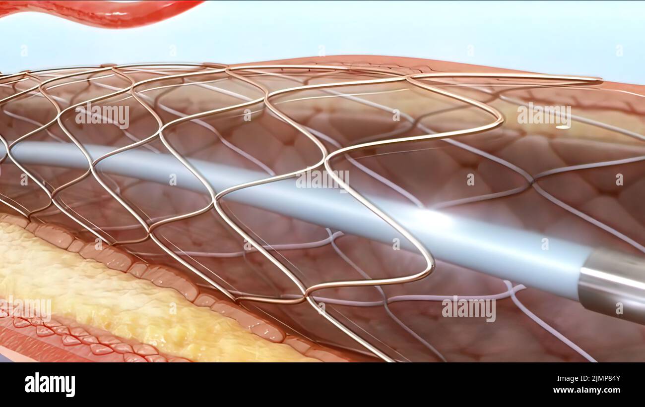 Blood flow simulation hi-res stock photography and images - Alamy