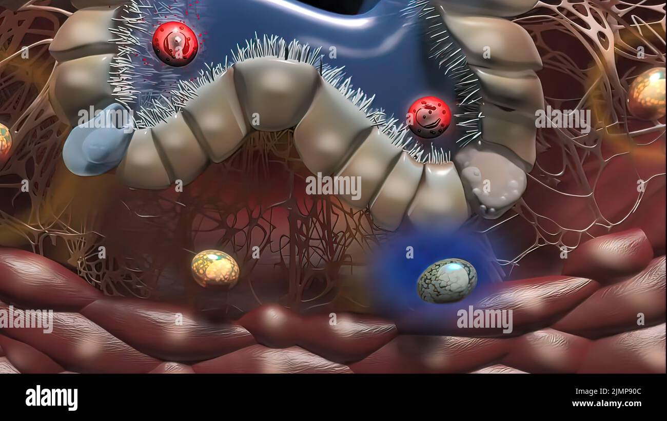 Inflammation of the lung hi-res stock photography and images - Alamy