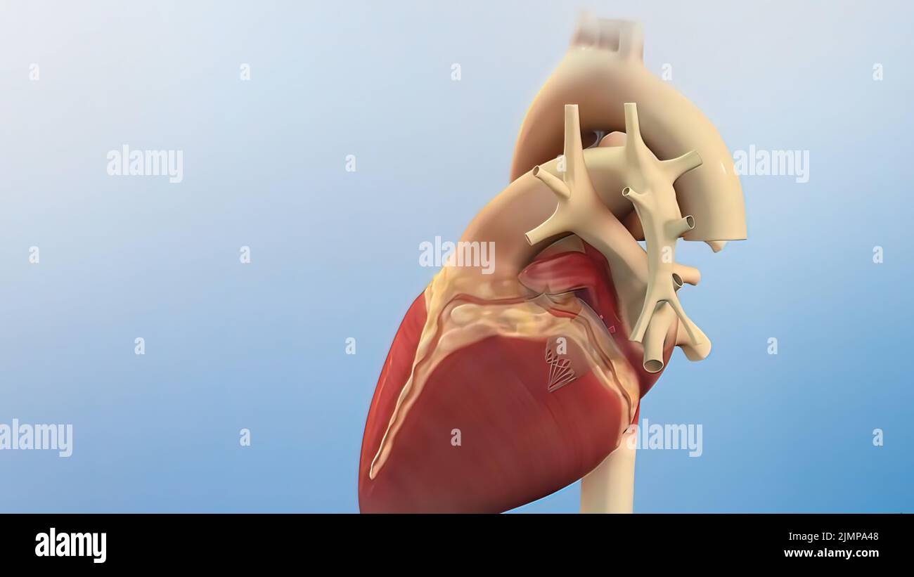 Anatomy heart attack model hi-res stock photography and images - Alamy