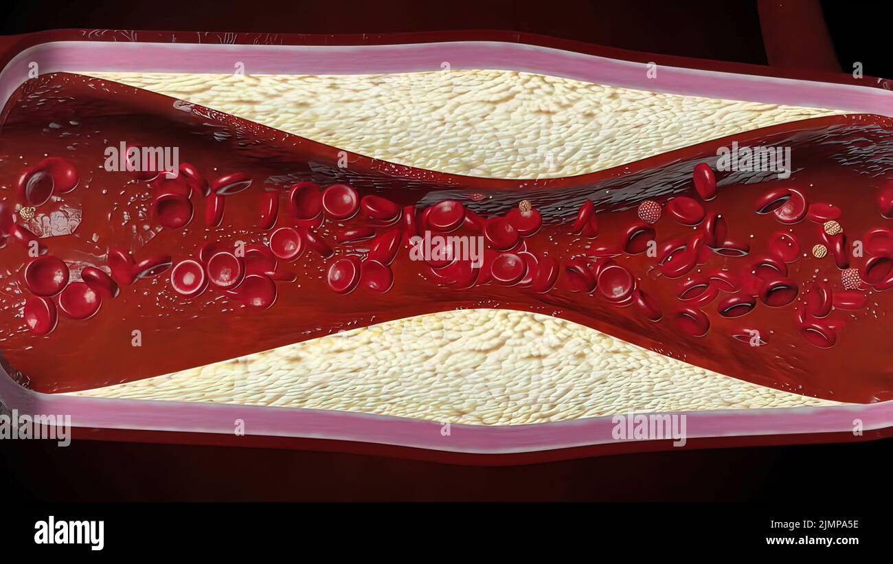 High cholesterol molecule hi-res stock photography and images - Alamy