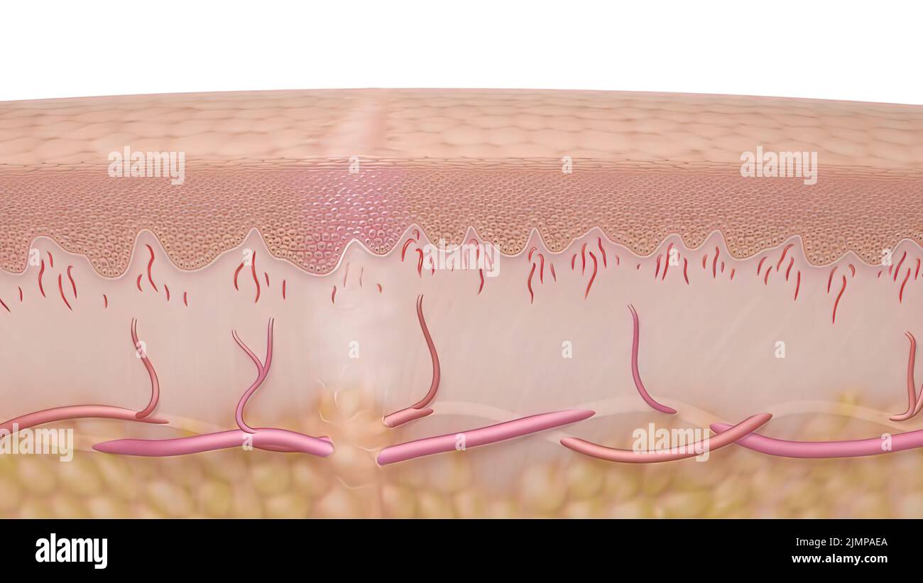 Healing skin diagram hi-res stock photography and images - Alamy