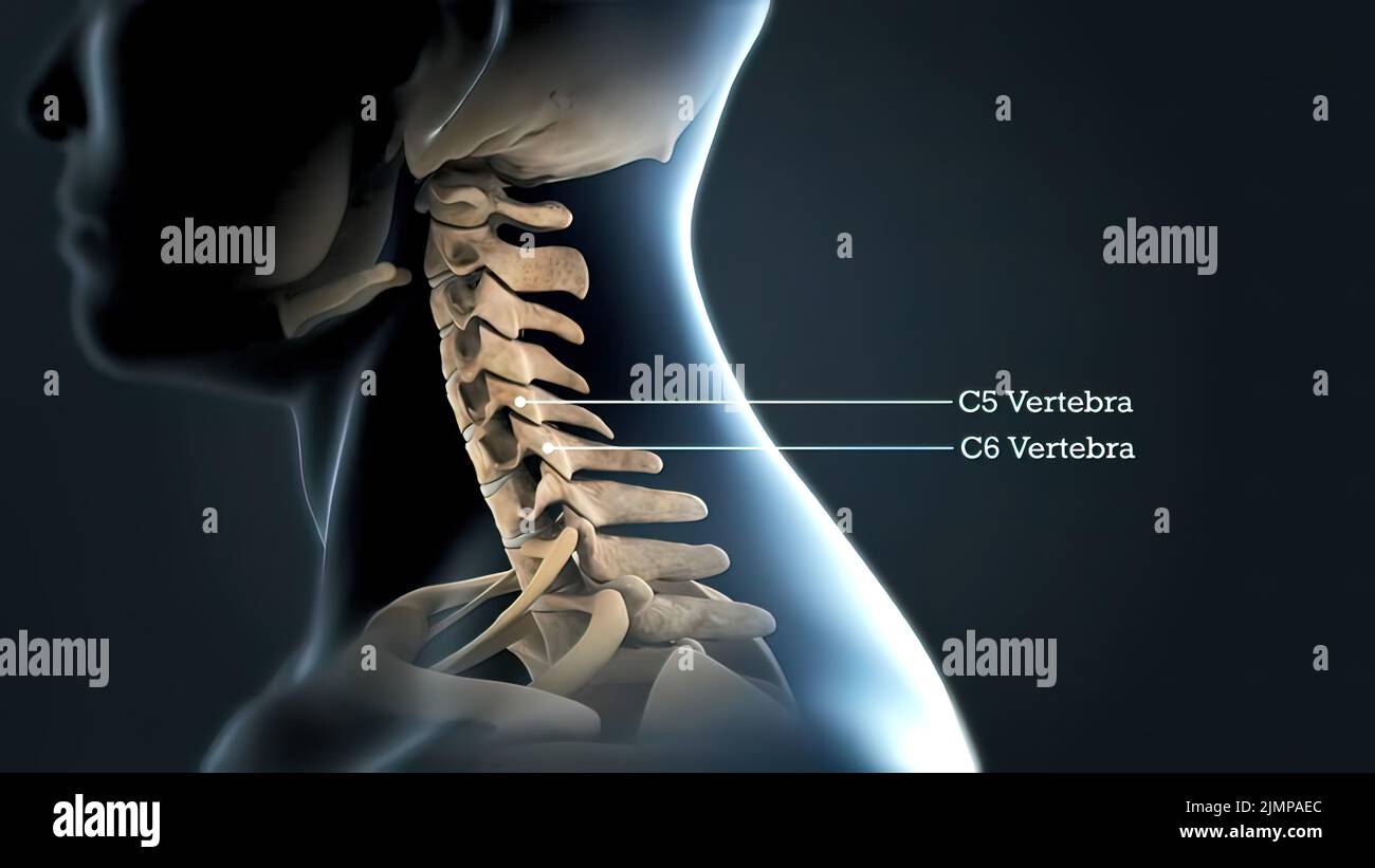 Human Cervical Spine Model Body Model Learning Props Cervical Spine ...