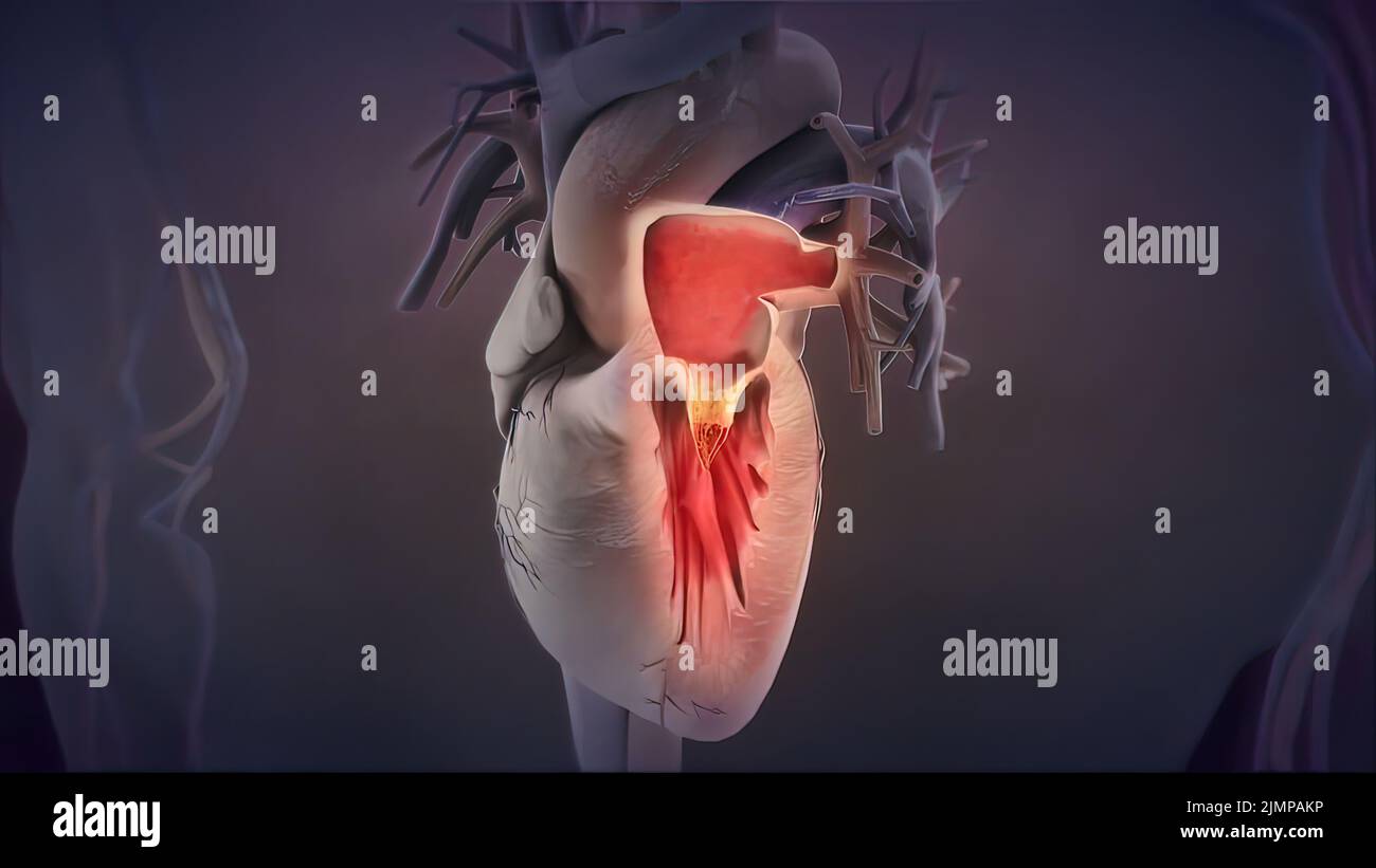 Body veins valves hi-res stock photography and images - Alamy