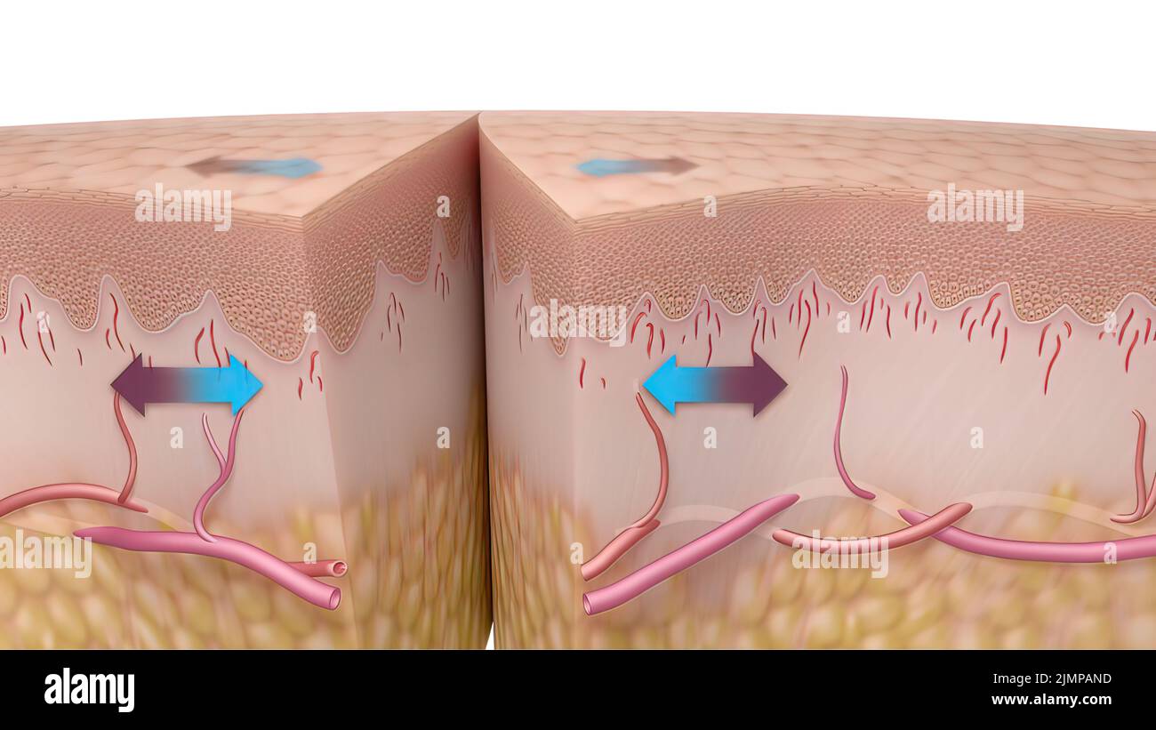 Healing skin diagram hi-res stock photography and images - Alamy