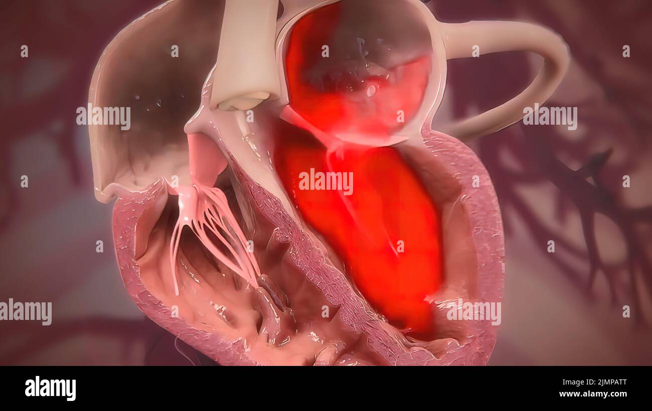 Cardiopulmonary disease hi-res stock photography and images - Alamy