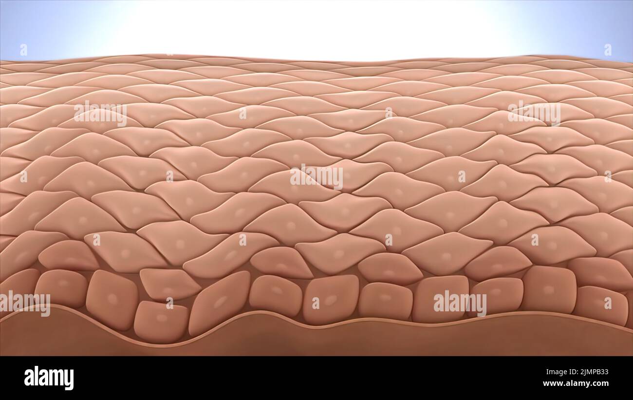 Hyperkeratinization hi-res stock photography and images - Alamy