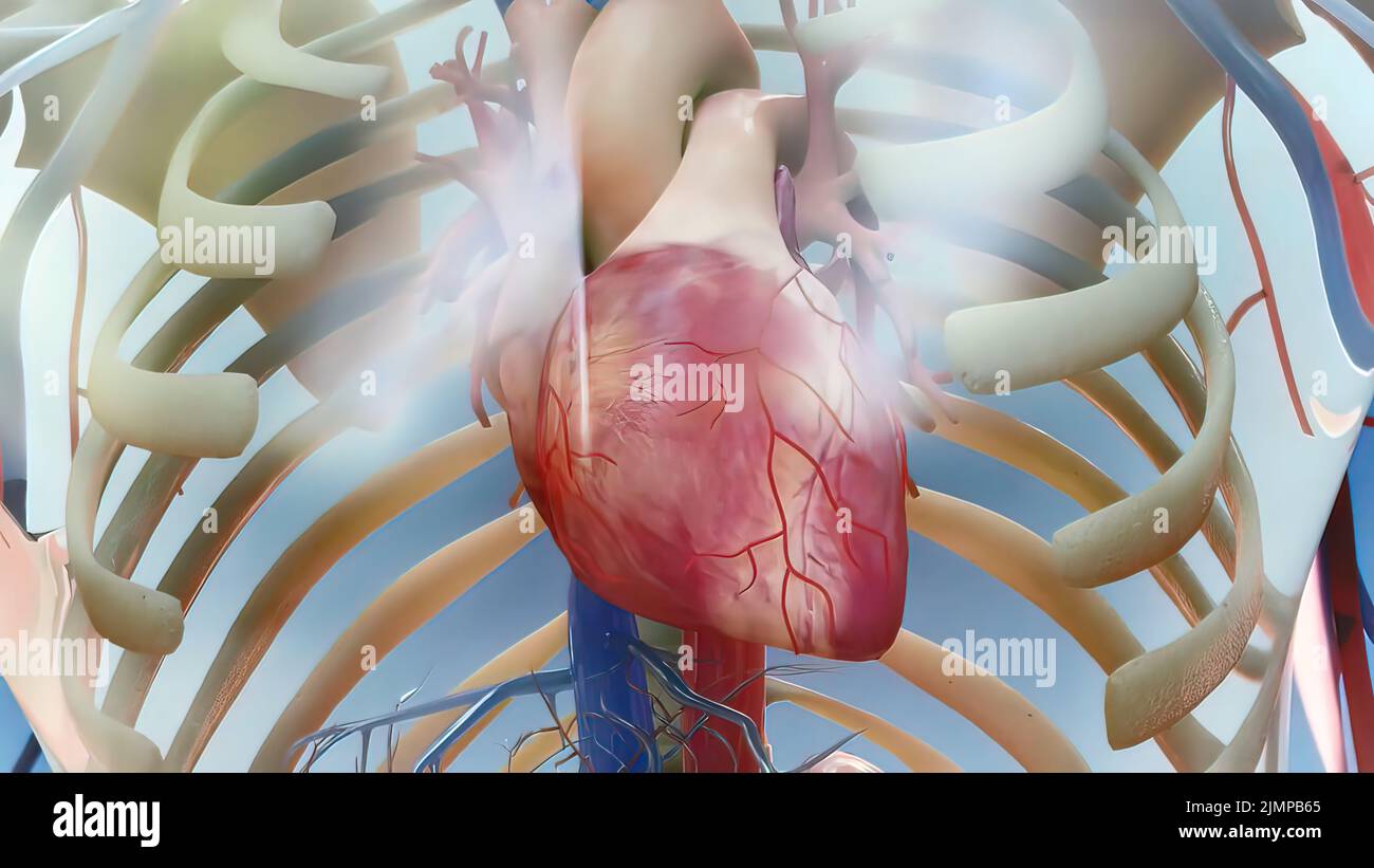 Heart is unable to pump hi-res stock photography and images - Alamy