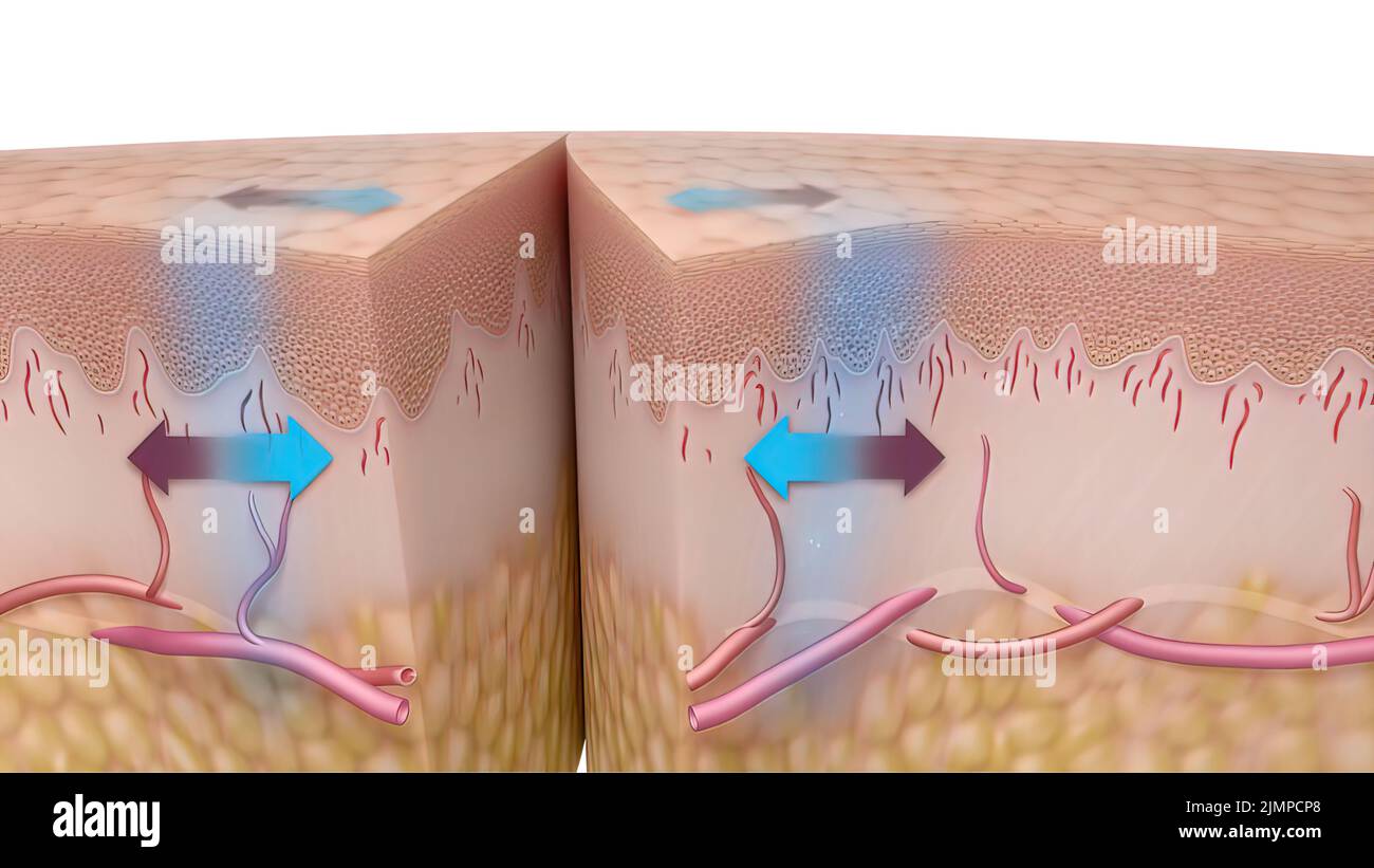 Healing skin diagram hi-res stock photography and images - Alamy