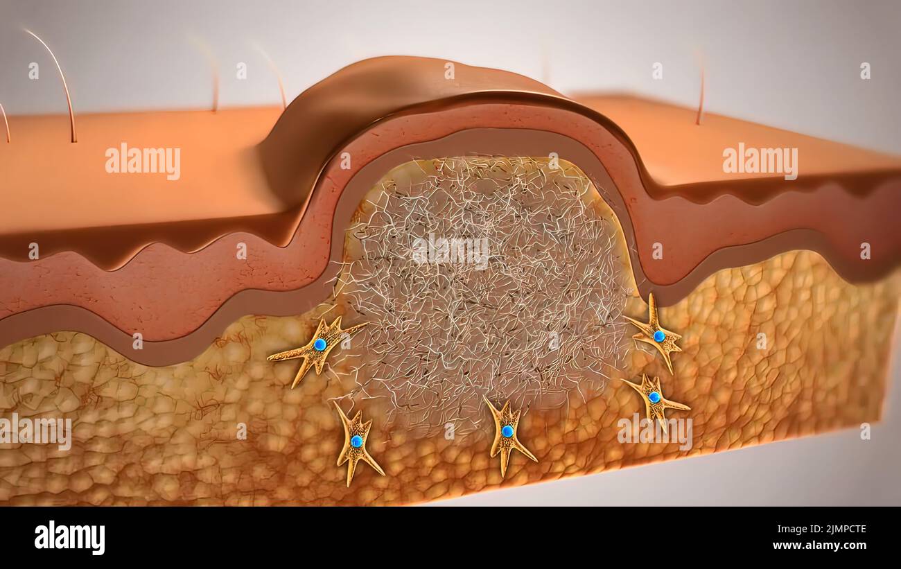 Skin regenerate hi-res stock photography and images - Alamy