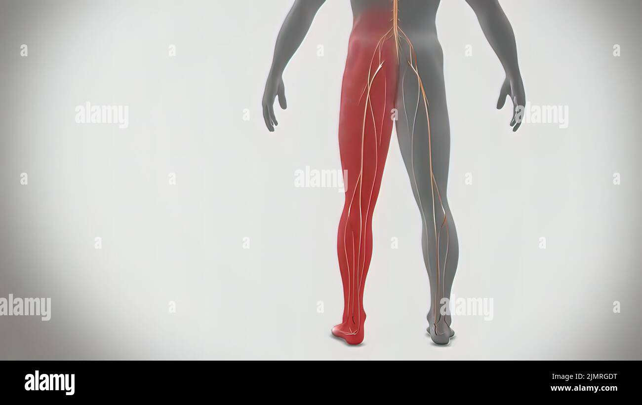 Neuropathology hi-res stock photography and images - Alamy