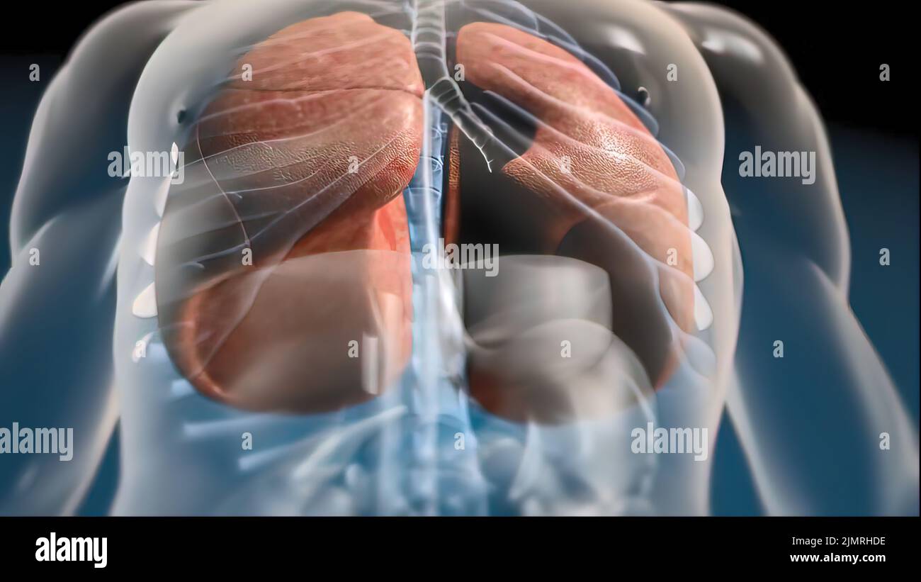 Lung scan hi-res stock photography and images - Alamy