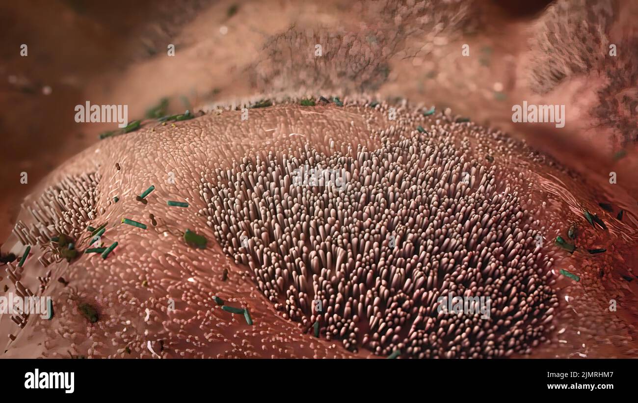 Cancer cell sem lymphocyte hi-res stock photography and images - Alamy