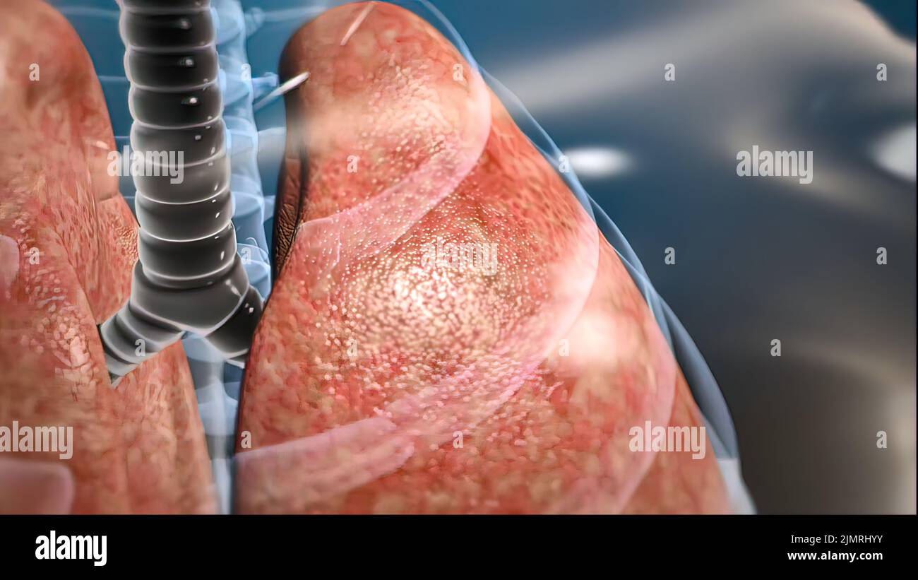 Anatomical cavity hi-res stock photography and images - Alamy