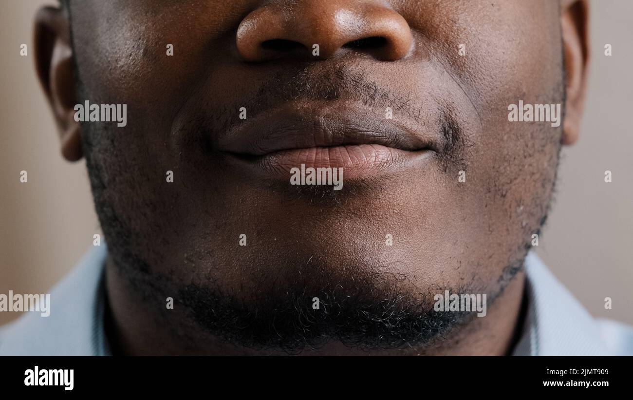 Orthodontic smile hi-res stock photography and images - Alamy