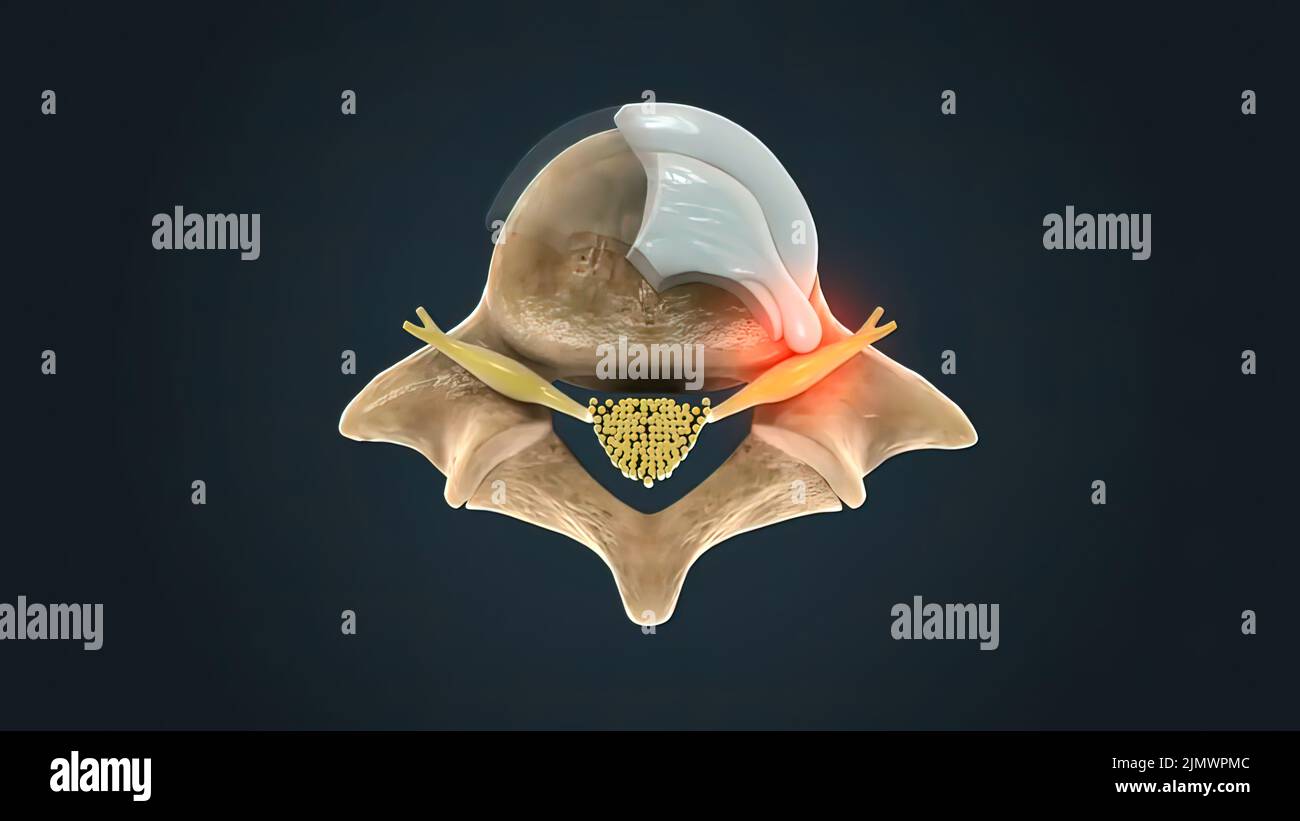 Spinal marrow nerves hi-res stock photography and images - Alamy