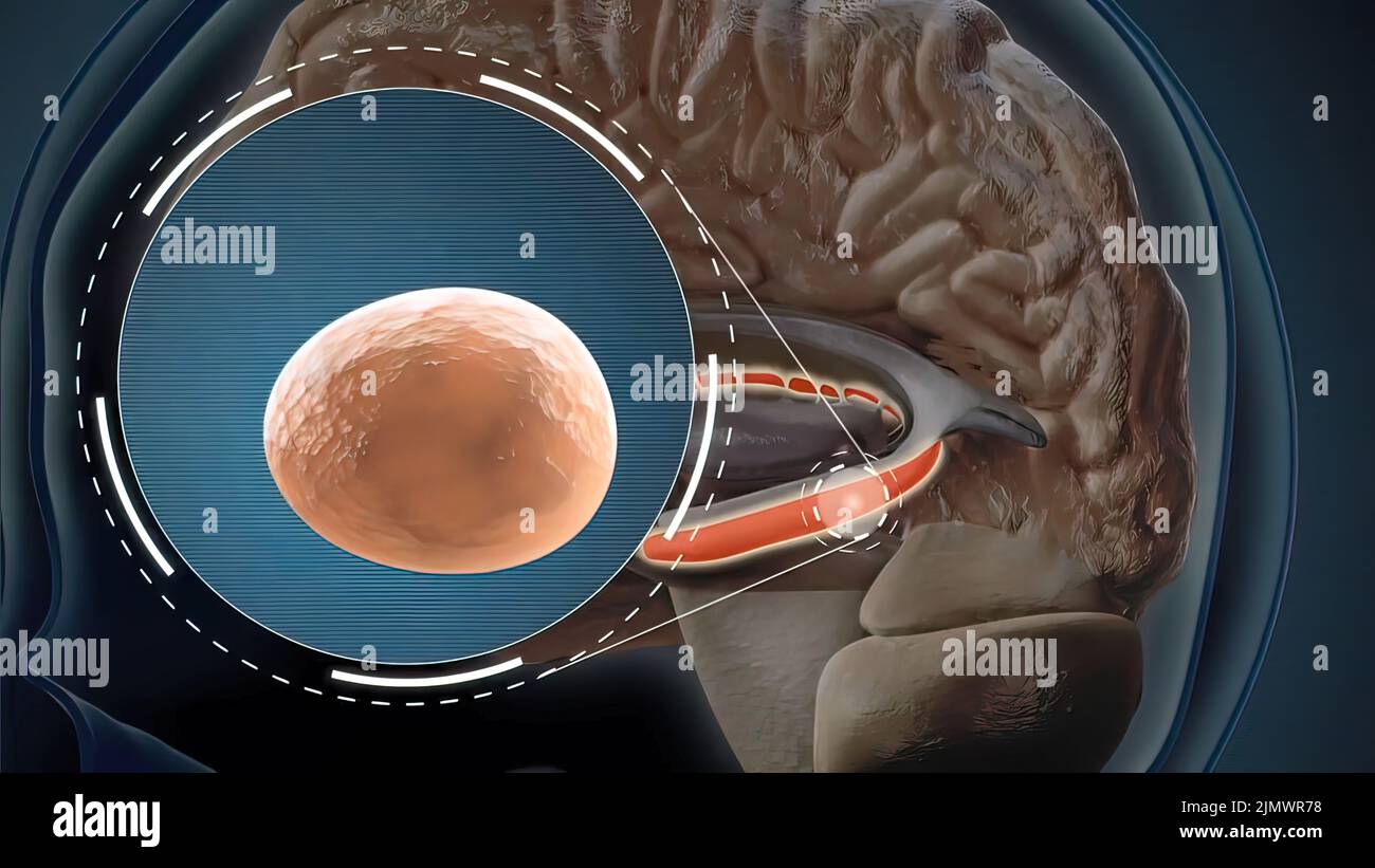 Hippocampus brain anatomy hi-res stock photography and images - Alamy
