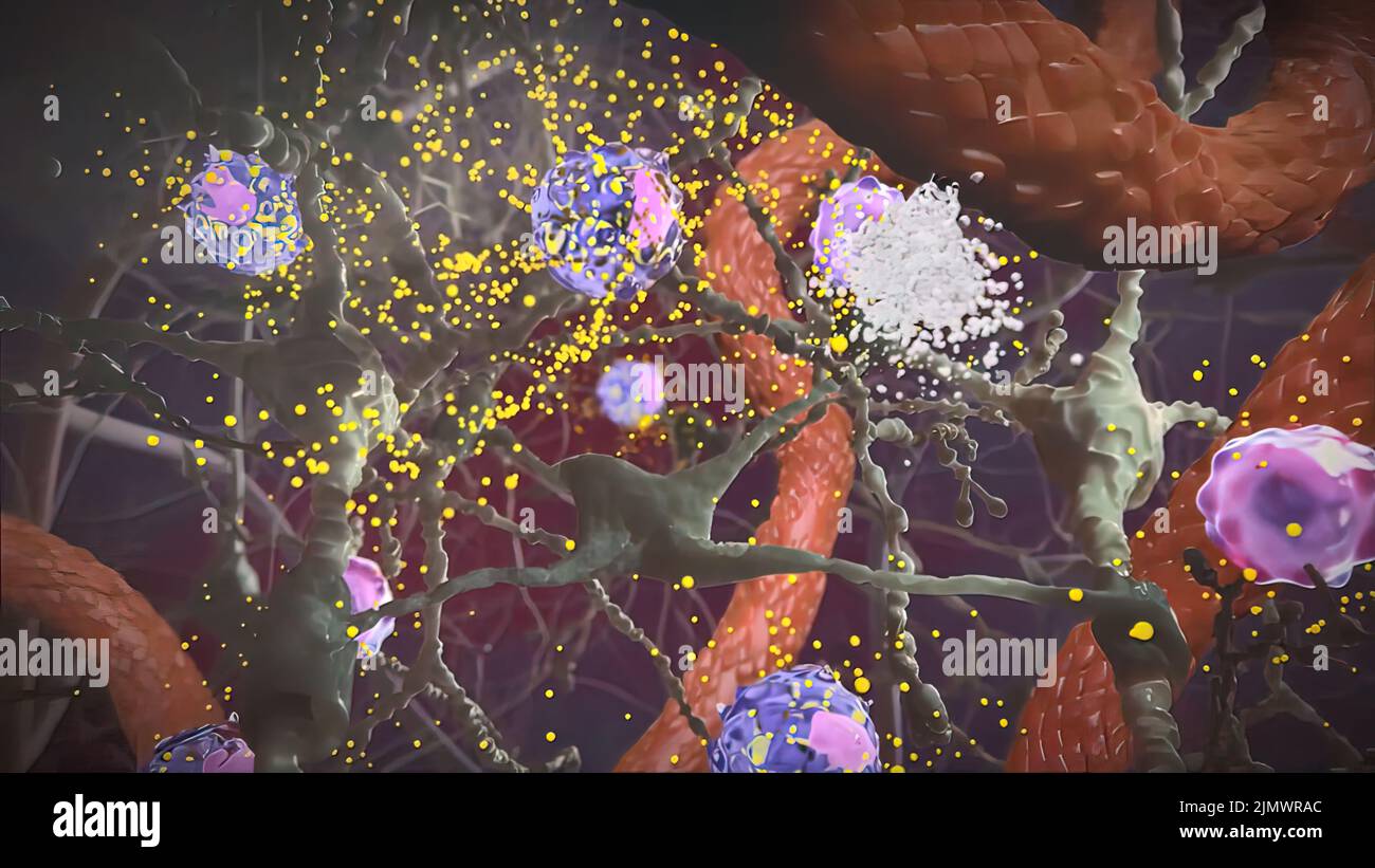 Neuro connections hi-res stock photography and images - Alamy