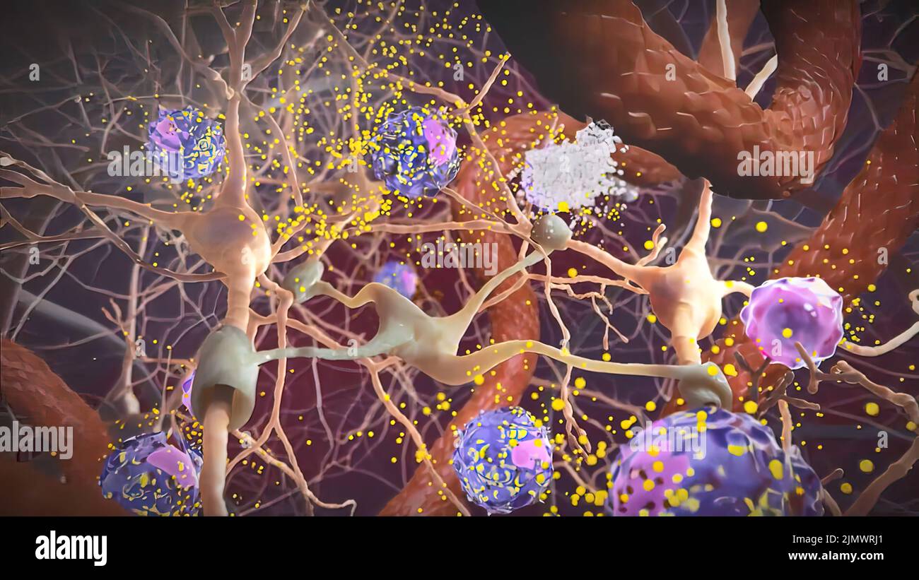 Neuro connections hi-res stock photography and images - Alamy