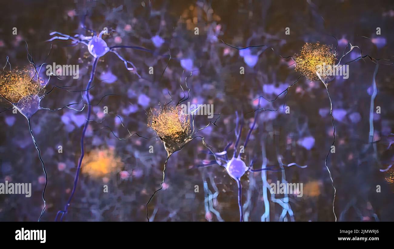 Neurons electrical light hi-res stock photography and images - Alamy