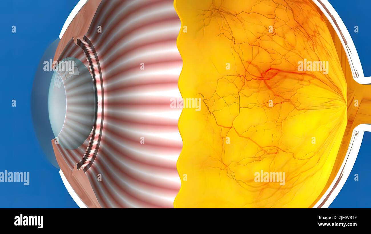 Normal pressure glaucoma hi-res stock photography and images - Alamy