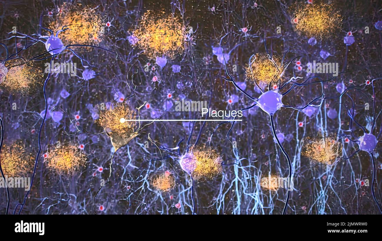 Neuro connections hi-res stock photography and images - Alamy