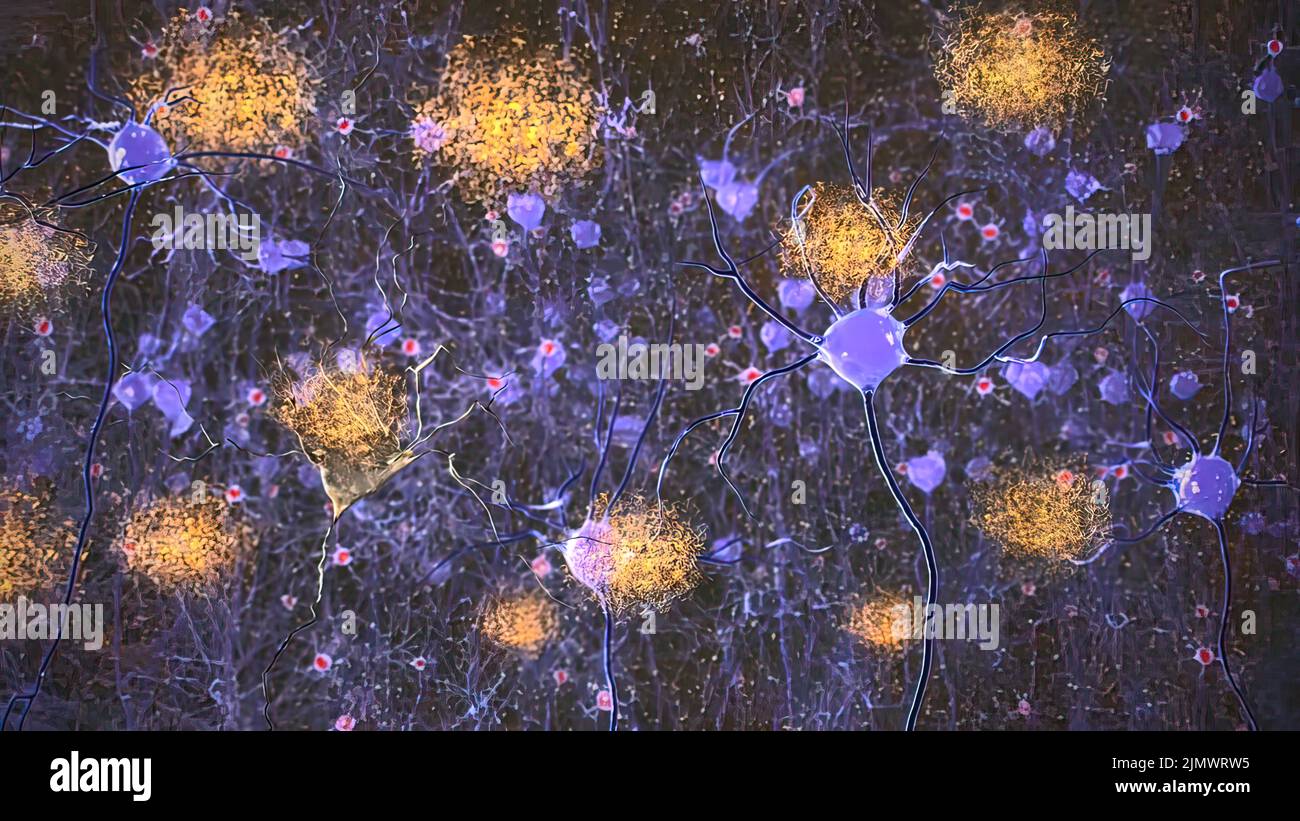 Neuro connections hi-res stock photography and images - Alamy