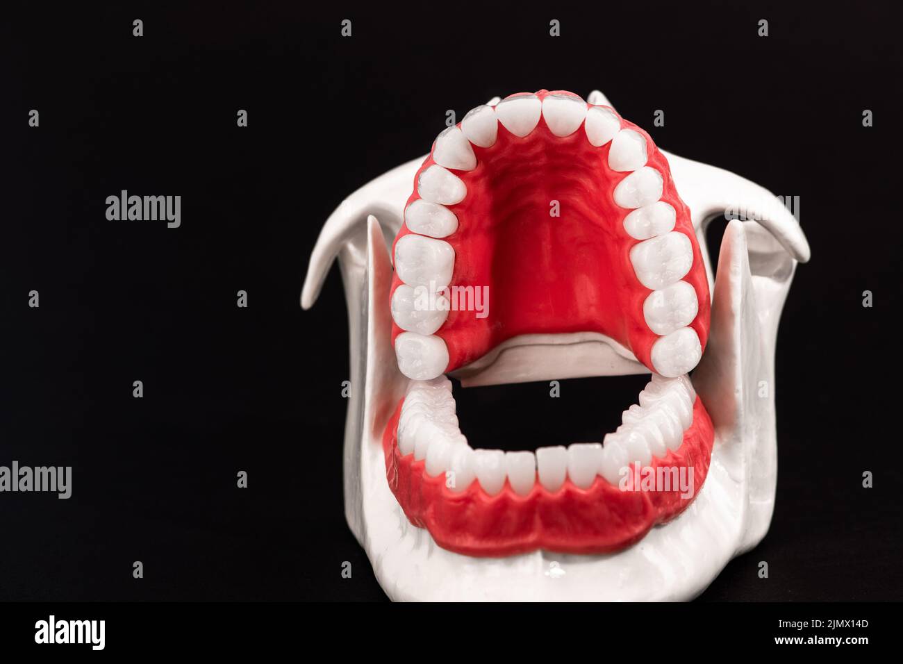 Human jaw with teeth and gums anatomy model isolated on black ...