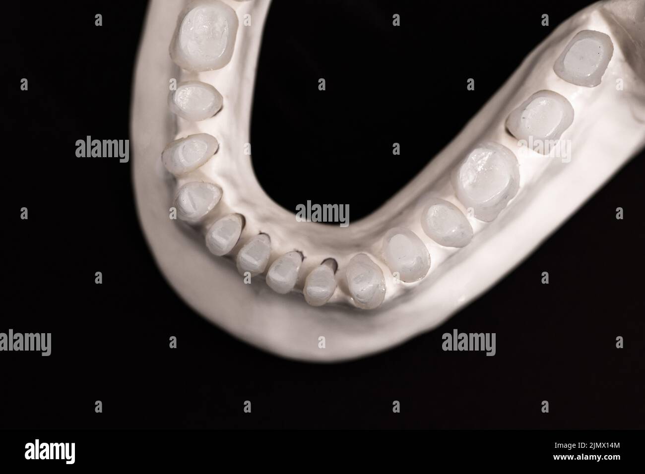 Lower human jaw with teeth anatomy model isolated on black background ...