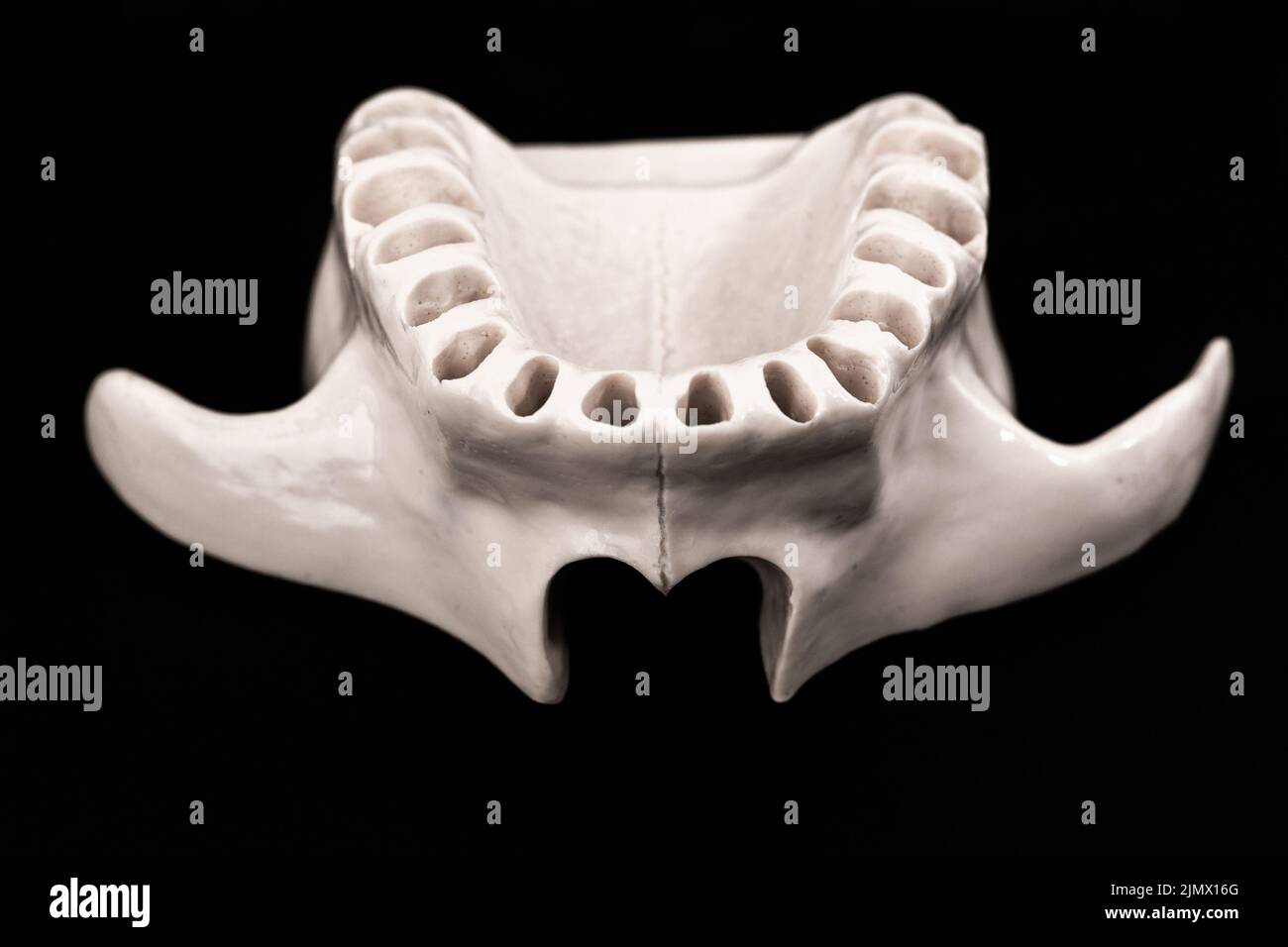 Upper human jaw without teeth model medical implant isolated on black ...