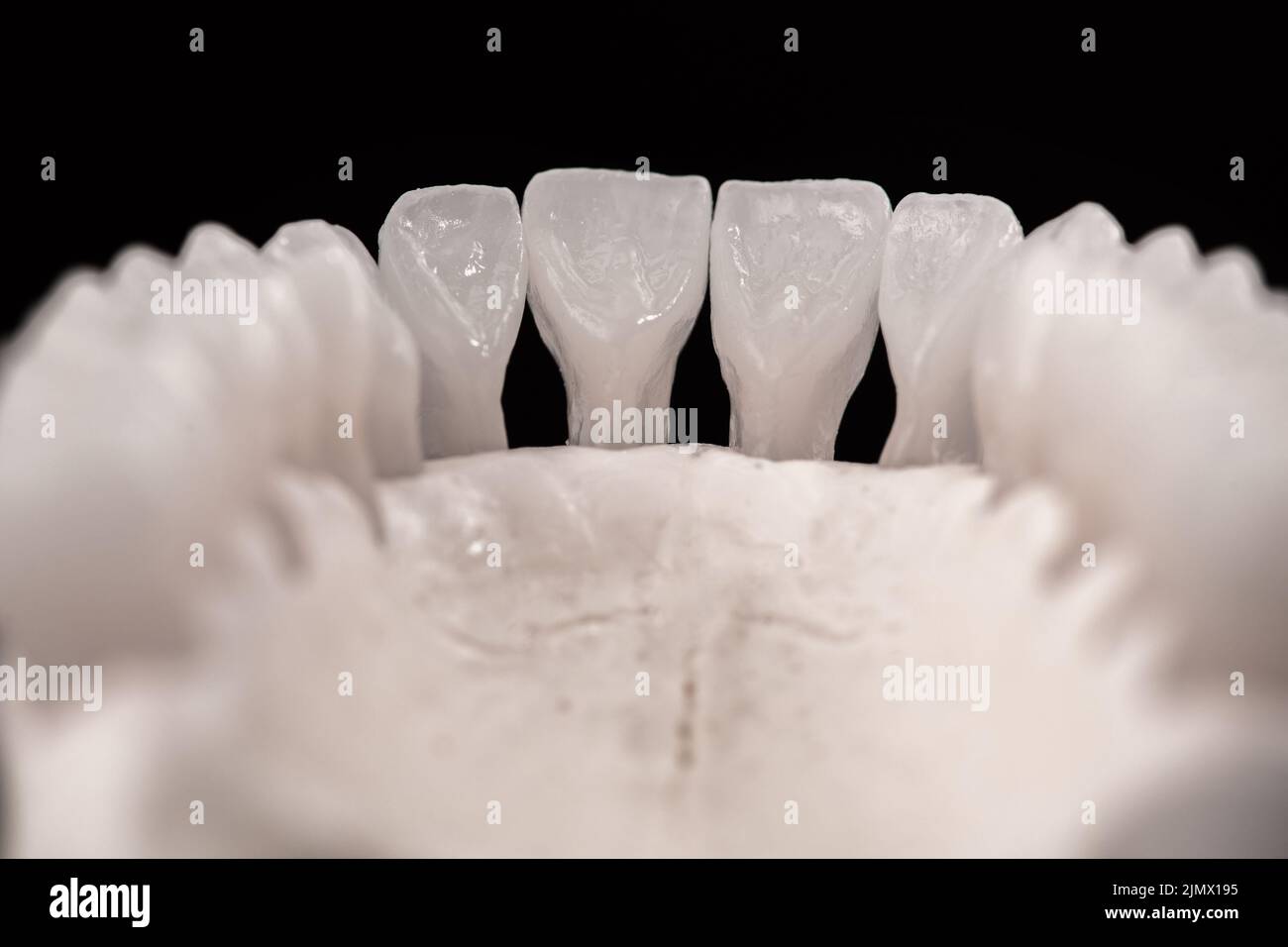 Lower human jaw with teeth anatomy model isolated on black background ...