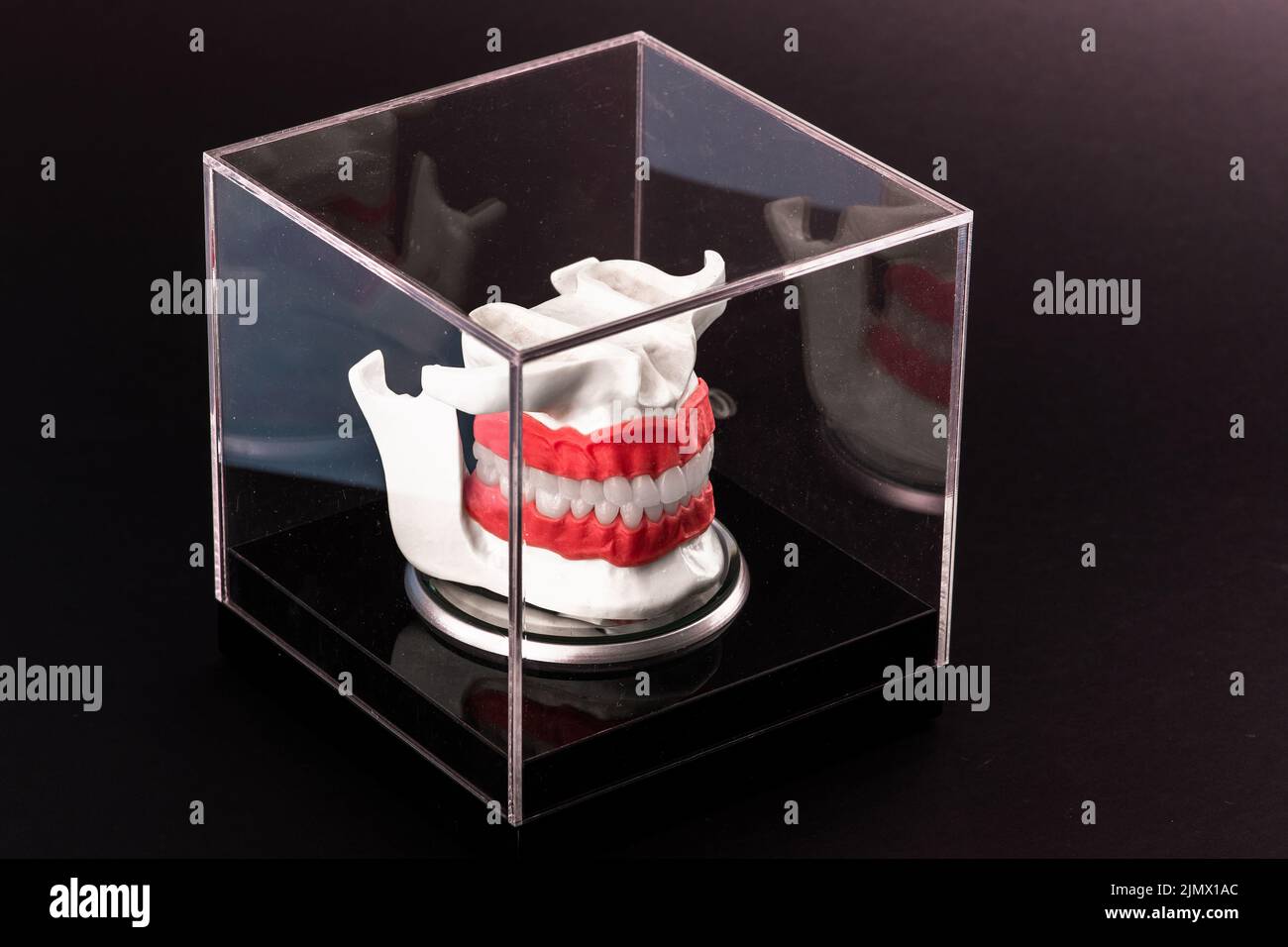 Human jaw with teeth implants anatomy model isolated on black ...