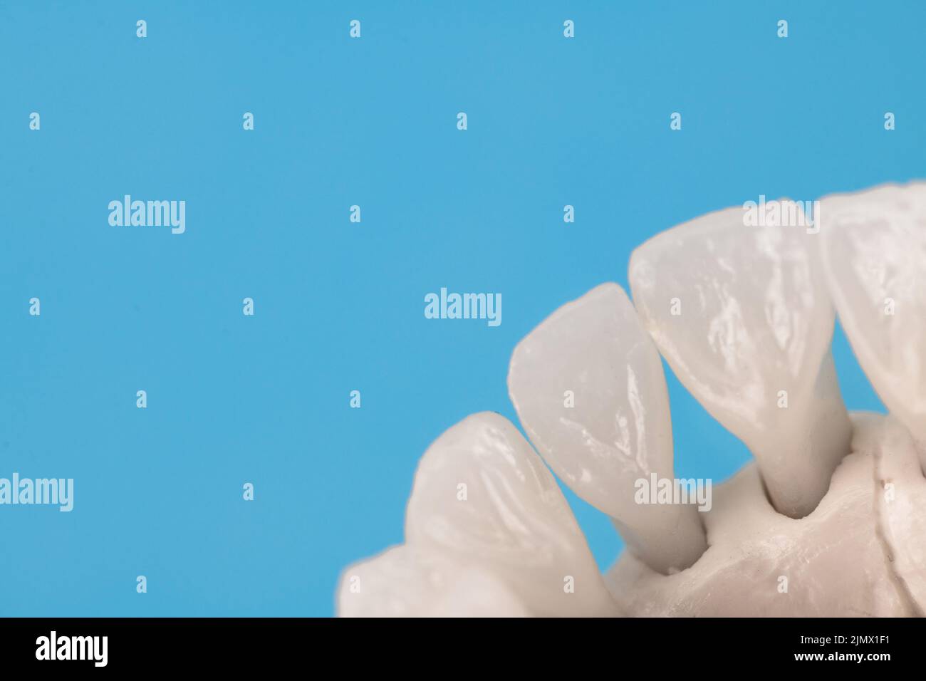 Upper human jaw with teeth anatomy model isolated on blue background ...