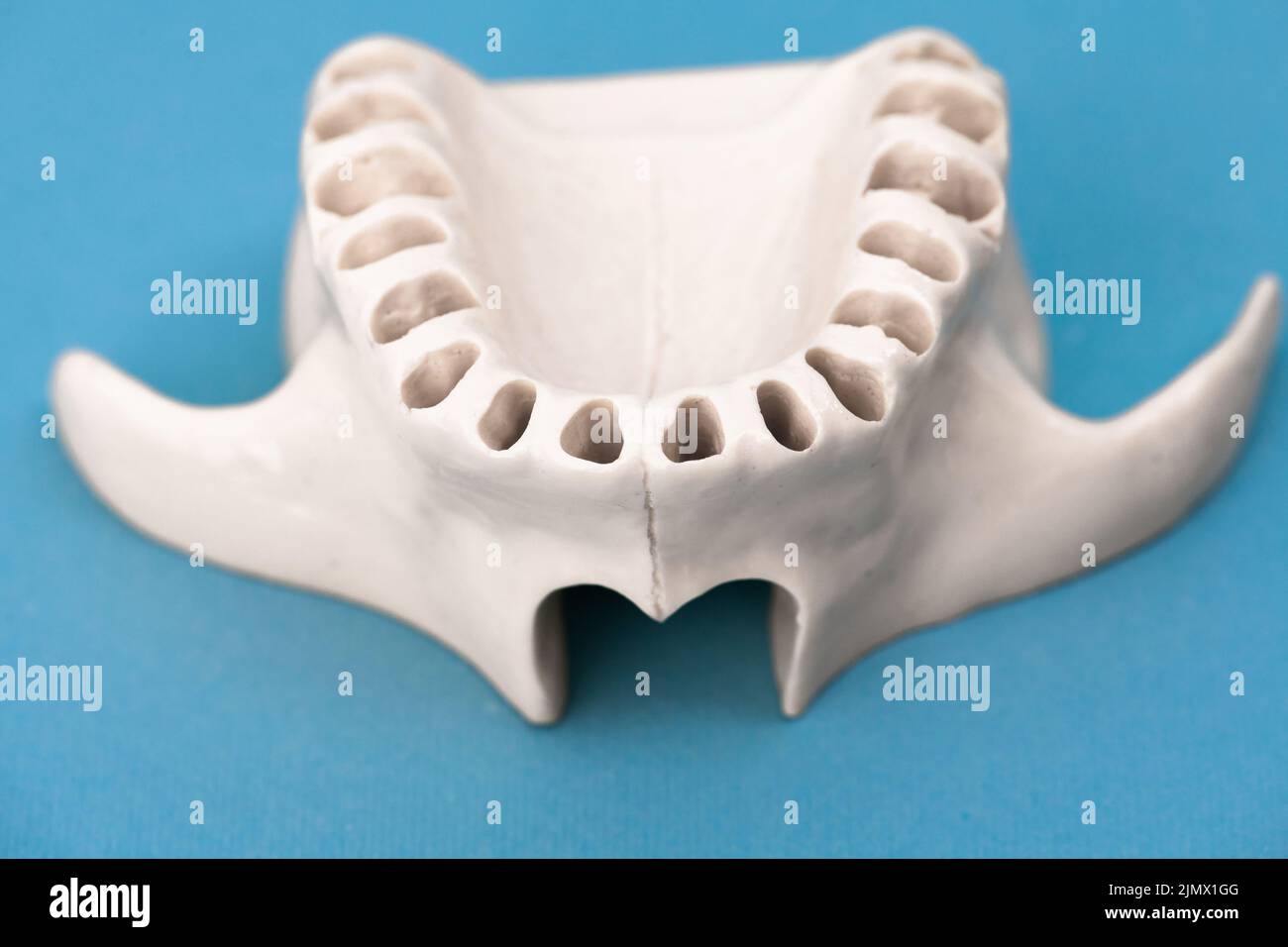 Upper human jaw without teeth model medical implant isolated on blue ...