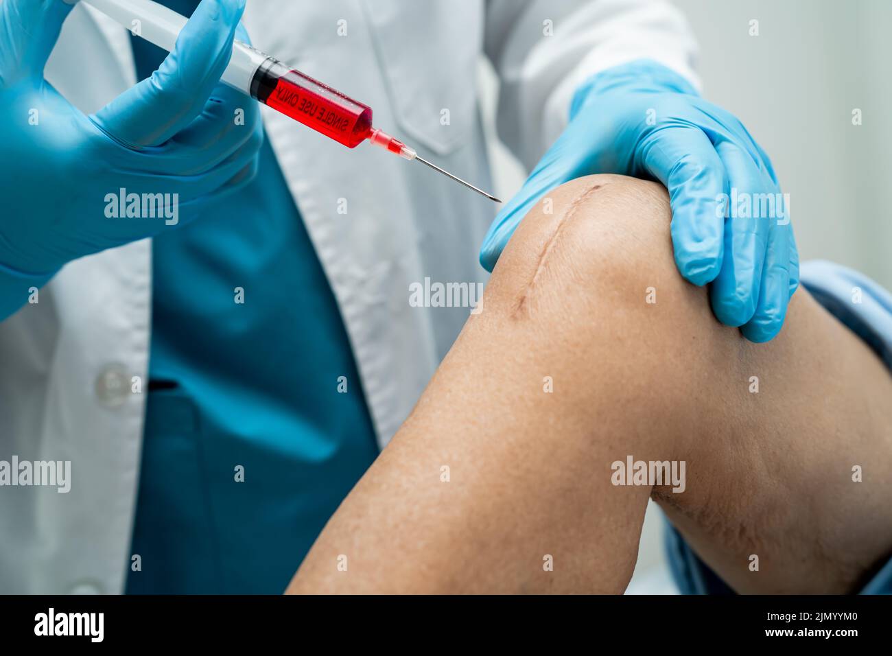 Hyaluronic knee hi-res stock photography and images - Alamy