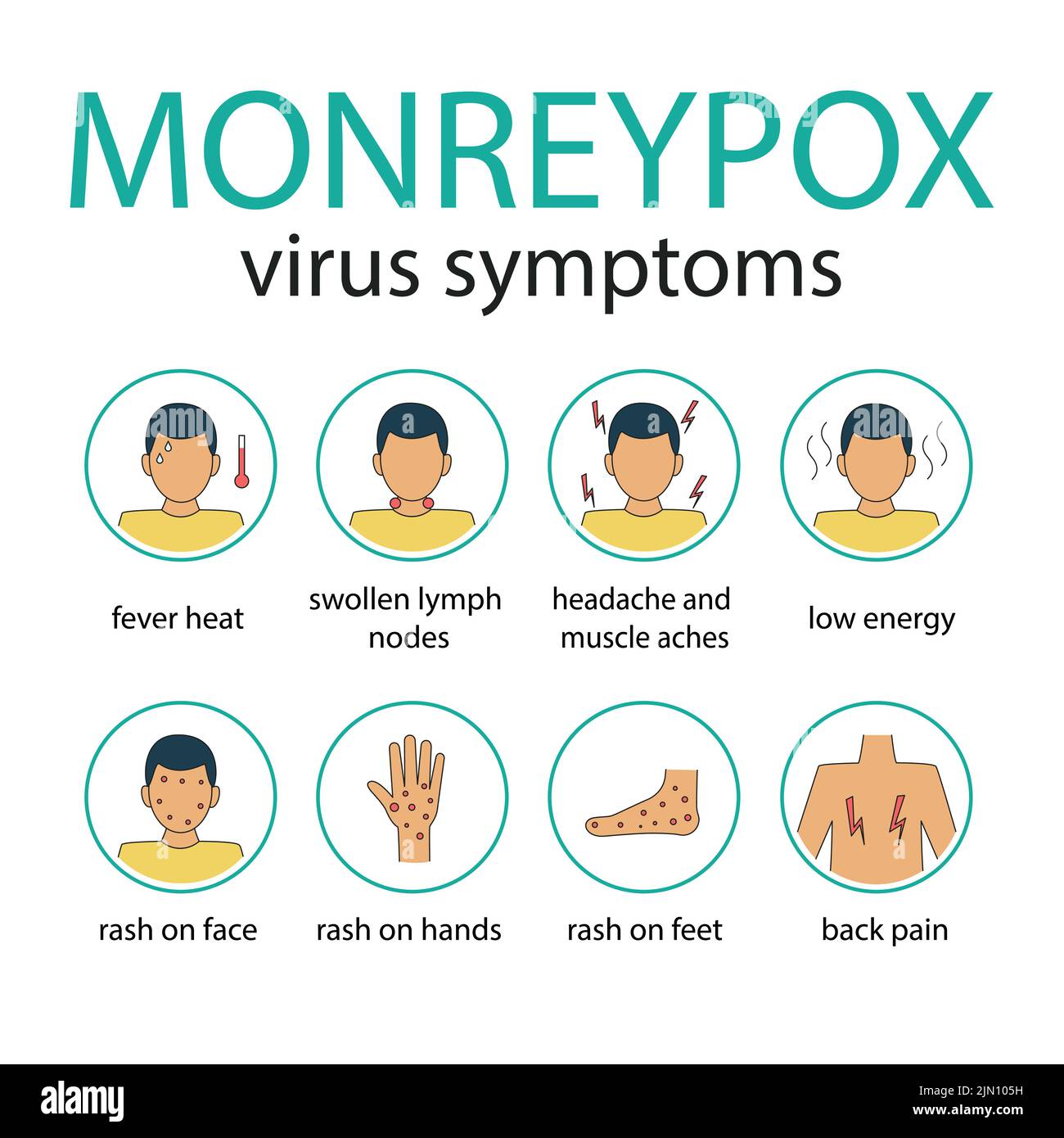 Monkeypox virus symptoms detailed infographic Stock Vector Image & Art ...