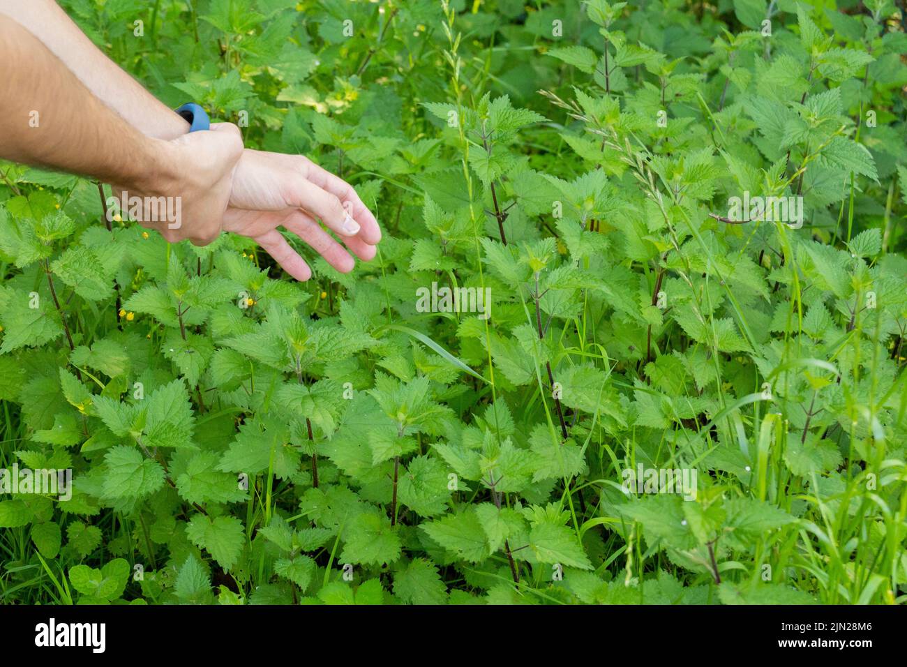 sore hand from touching nettles or stinging nettles Stock Photo - Alamy