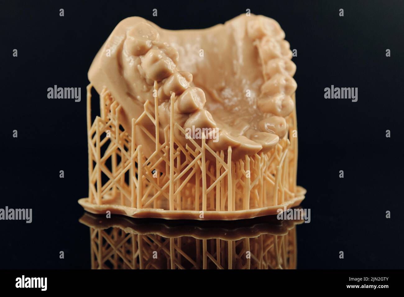 3D Printing Dental Crowns and Bridge Models. Orthodontic model for ...