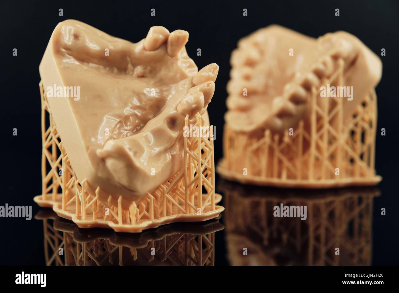 3d Printing Dental Crowns And Bridge Models Orthodontic Model For Dental The Concept Of