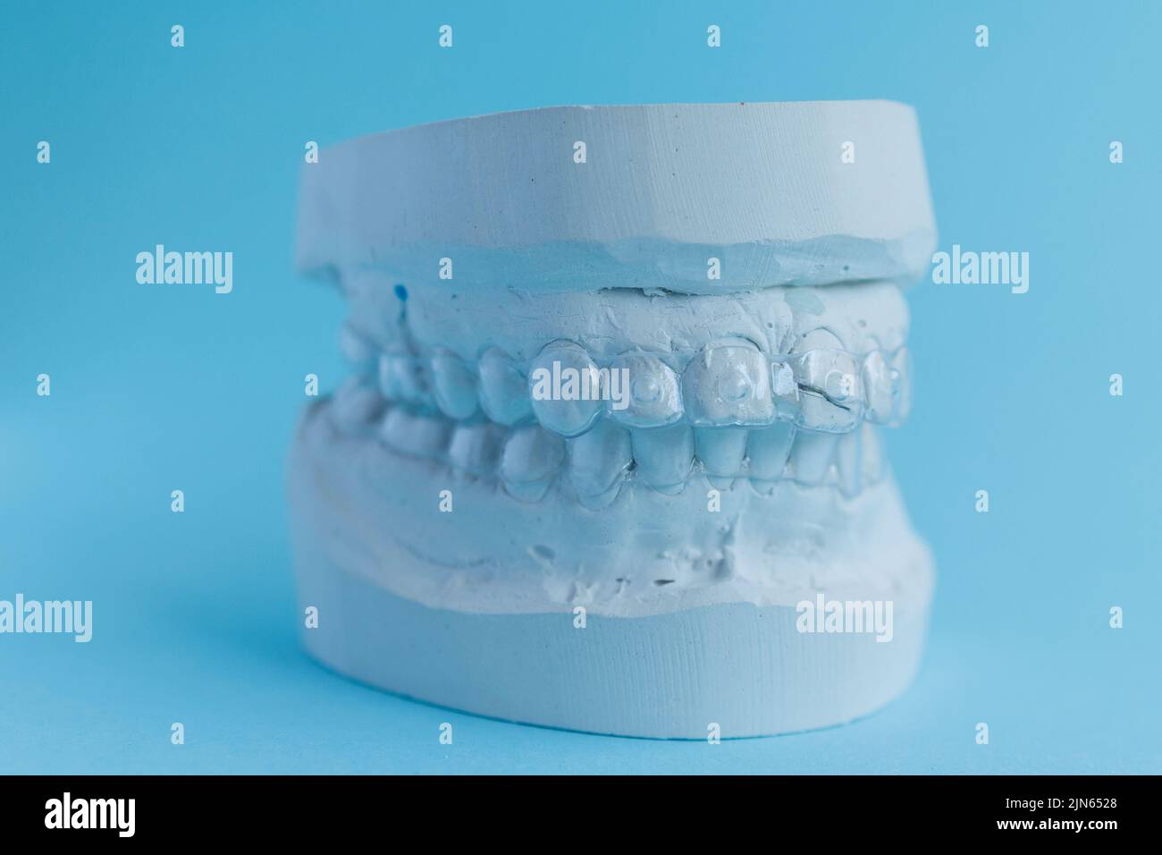 Gypsum mould of human jaw with transparent aligner, invisible retainer ...