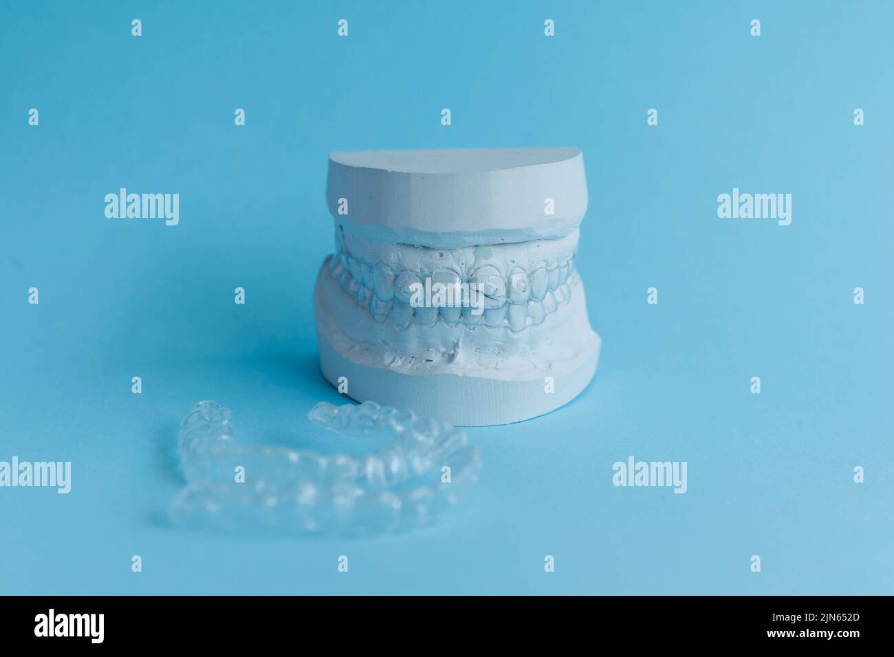 Plaster human jaw model and essix retainer for dental correction Stock ...