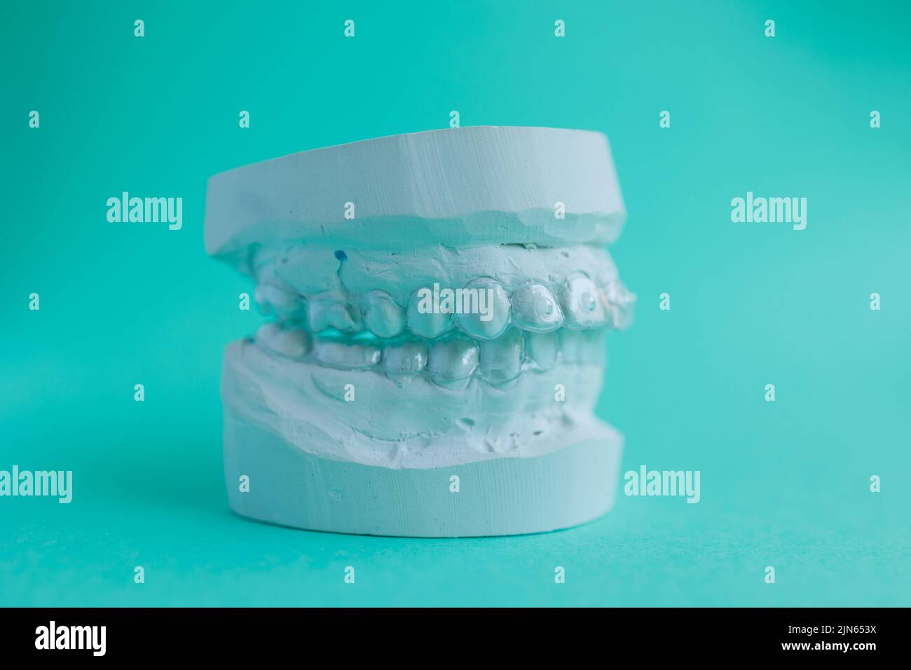 Plaster model of the human jaw with transparent silicone essix retainer ...