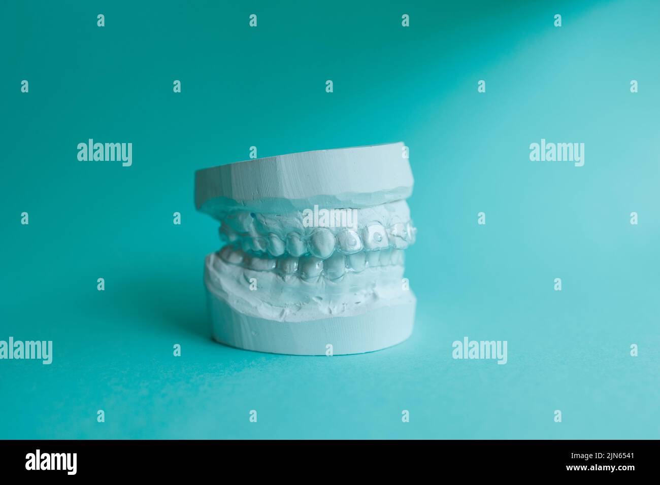 Plaster mould of human jaw with transparent aligner, invisible retainer ...