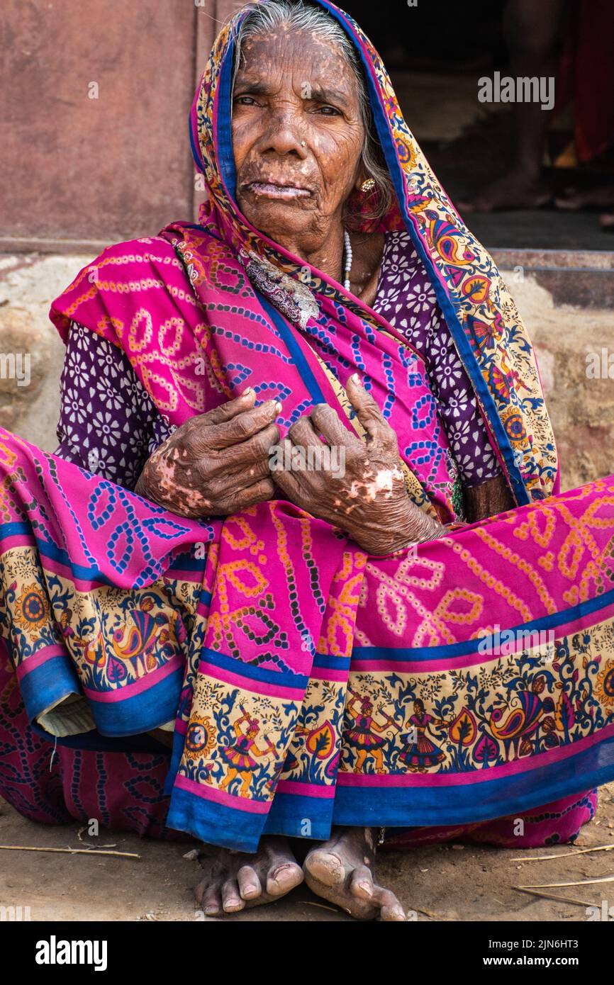 Refugee asian medical camp hi-res stock photography and images - Alamy