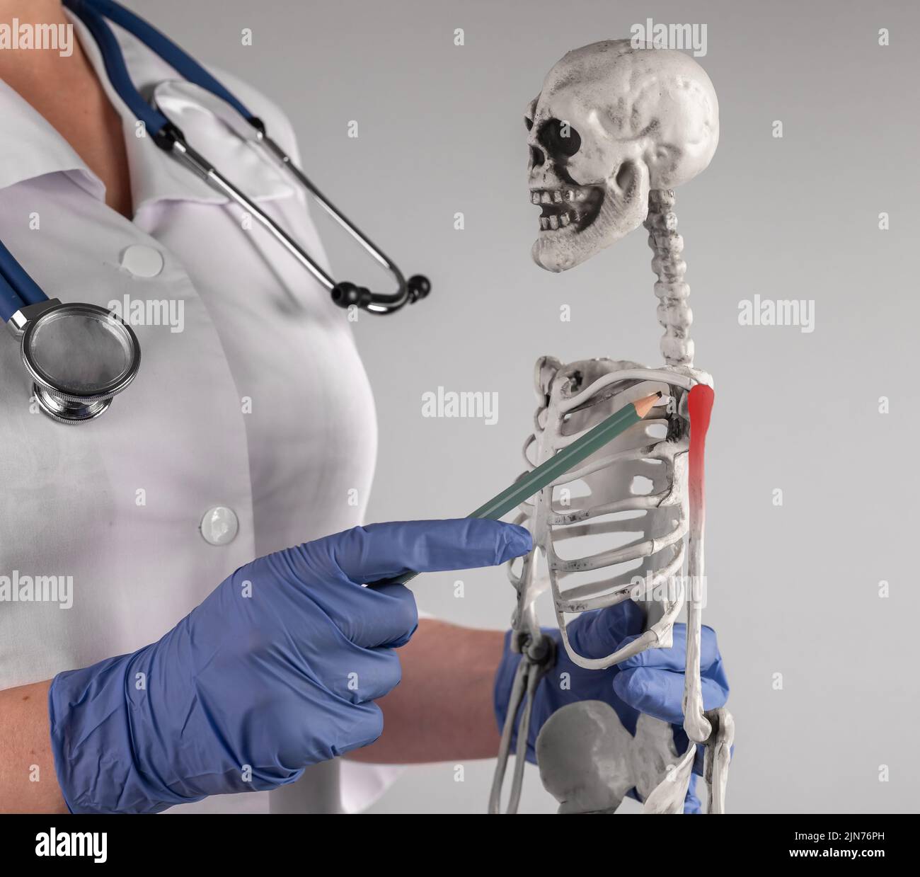 Doctor pointing to skeleton arm with red shoulder with pencil. Painful ...
